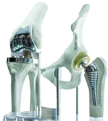 Orthopedic Analysis | ADVANCED IMMUNOLOGICAL TESTING LAB